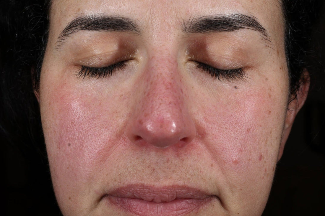 Plated INTENSE Serum | Free U.S. Shipping on Orders $49+ – Art of Skin Care